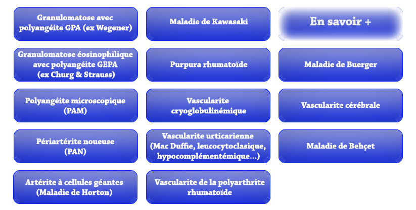 Vascularite cryoglobulinémique